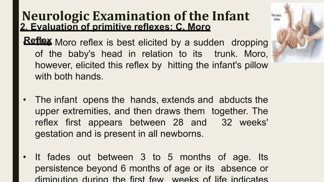 Pediatrics Neurological Examination.pptx