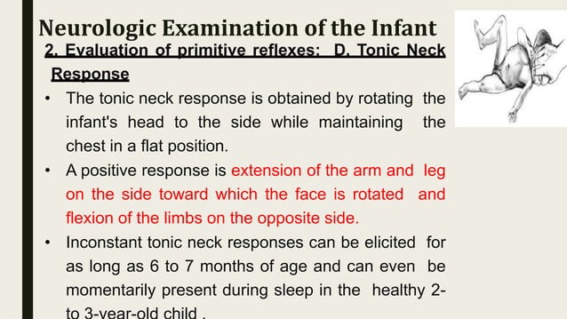 Pediatrics Neurological Examination.pptx