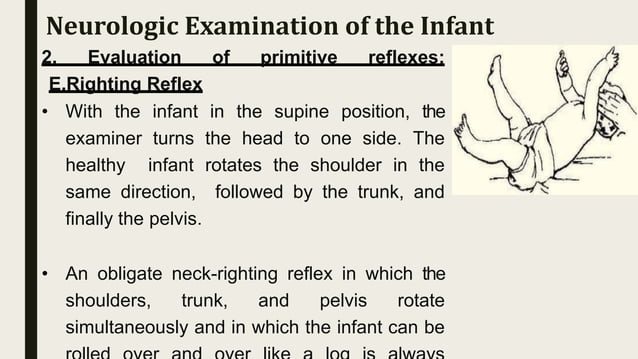 Pediatrics Neurological Examination.pptx