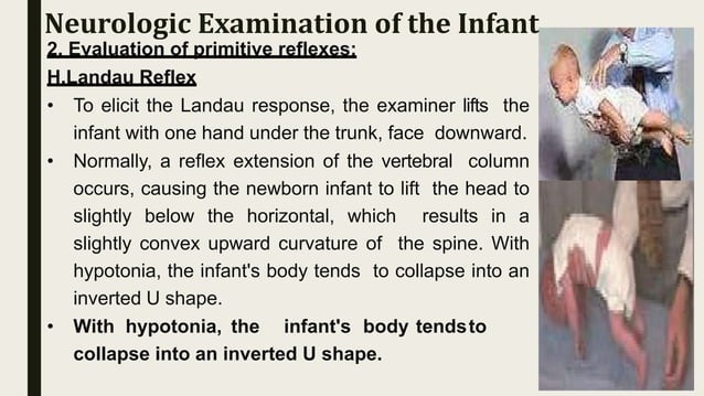 Pediatrics Neurological Examination.pptx