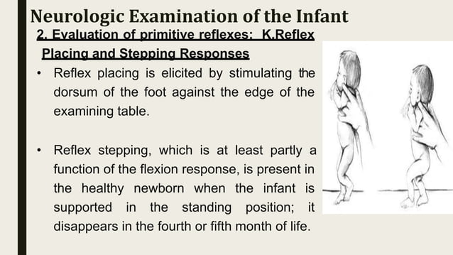 Pediatrics Neurological Examination.pptx