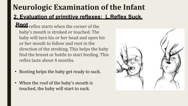 Pediatrics Neurological Examination.pptx