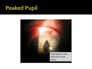 Pediatrics ocular trauma and emergencies | PPTX