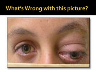 Pediatrics ocular trauma and emergencies | PPTX