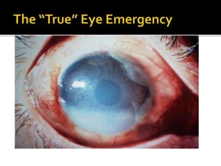 Pediatrics ocular trauma and emergencies | PPTX