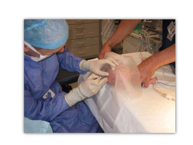 Pediatric spinal anaesthesia | PPTX