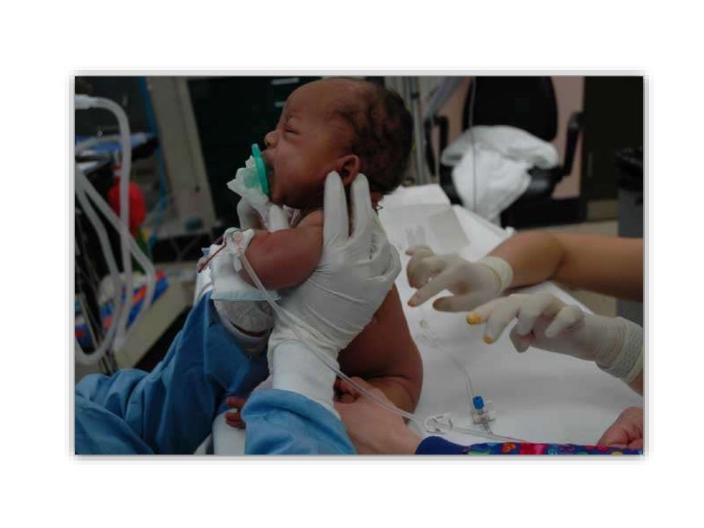 Pediatric spinal anaesthesia | PPTX