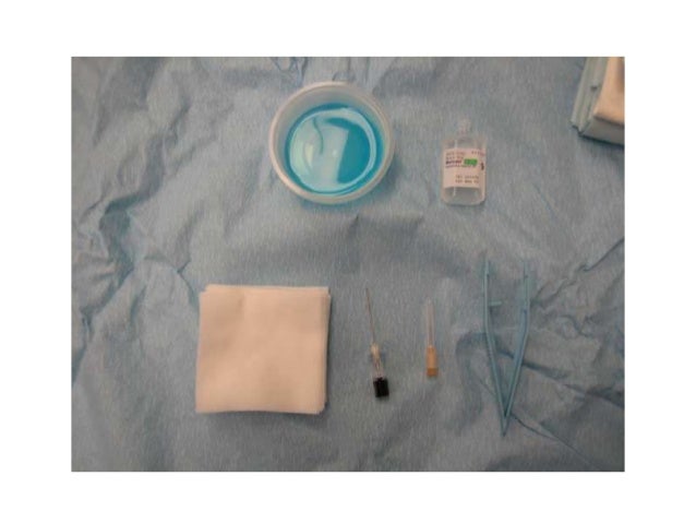 Pediatric spinal anaesthesia | PPTX