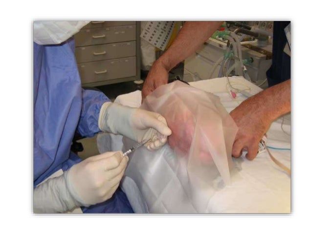 Pediatric spinal anaesthesia | PPTX