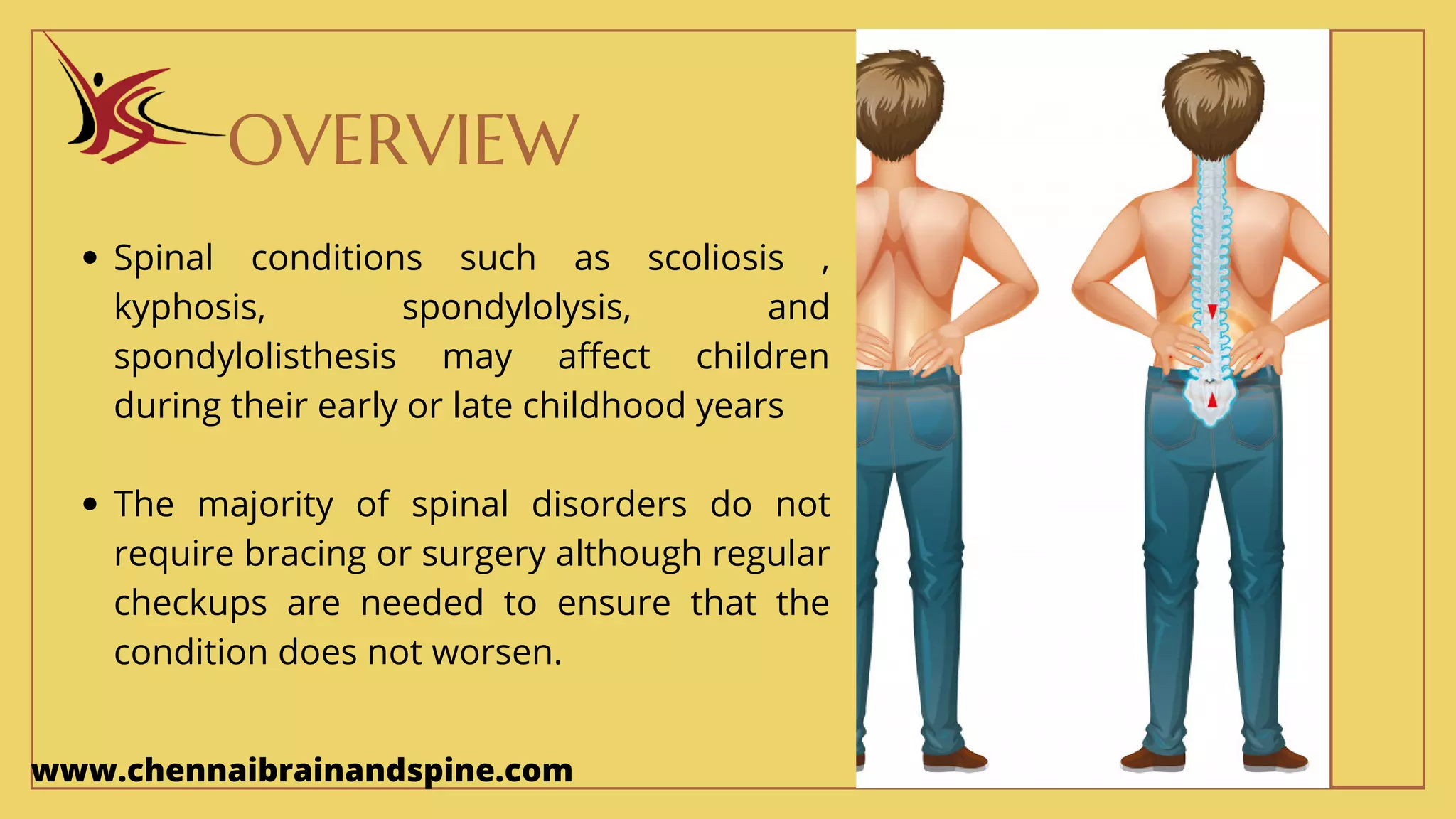 Pediatric spinal deformity | PDF