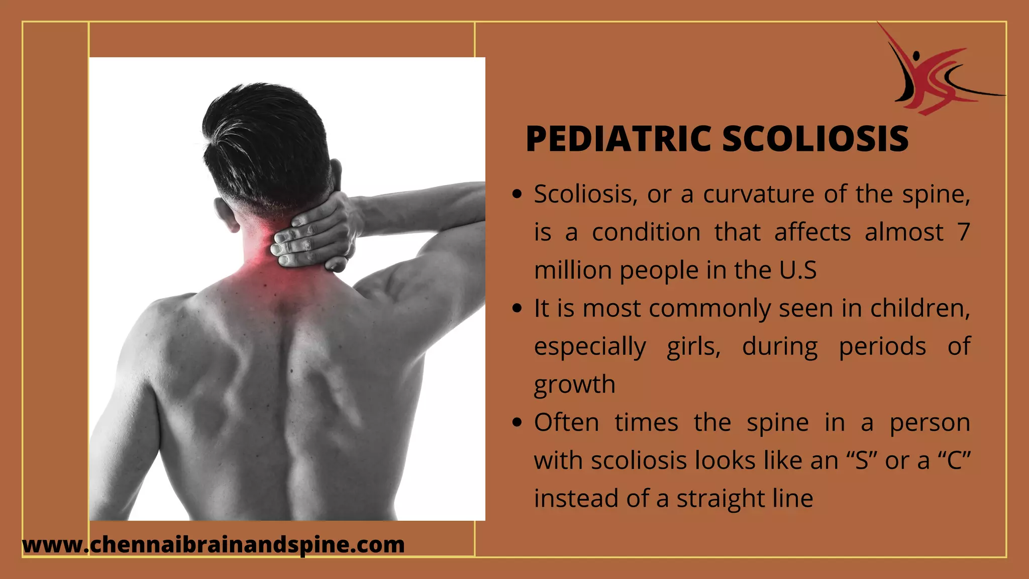 Pediatric spinal deformity | PDF