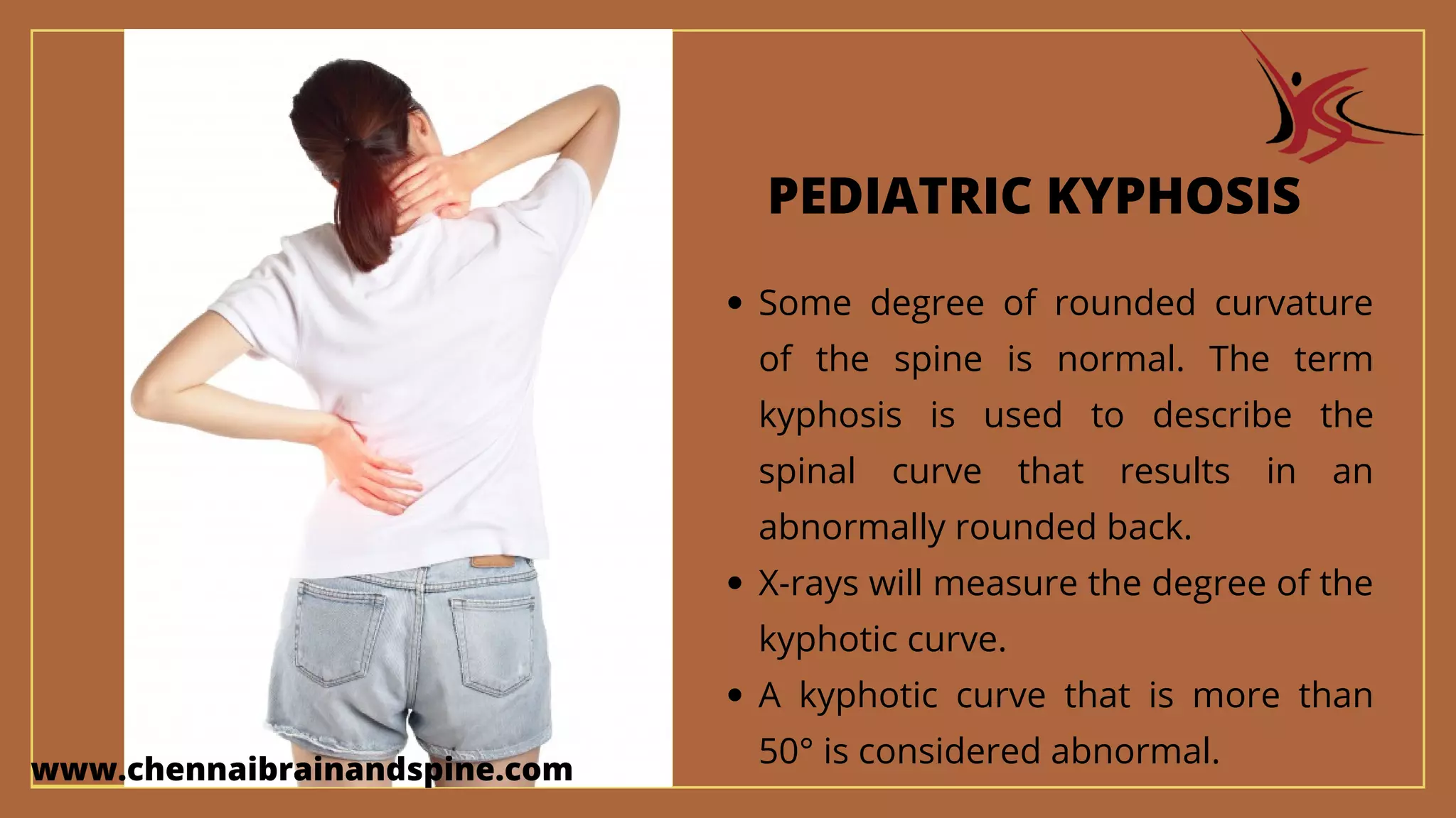 Pediatric spinal deformity | PDF