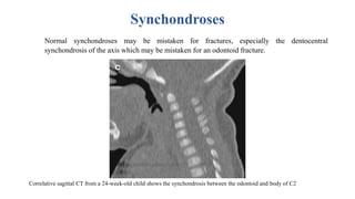 Pediatric spine injuries by Momen | PPTX