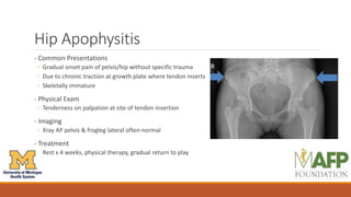 Pediatric Sports Medicine Ingrid Ichesco_0 (1).ppt