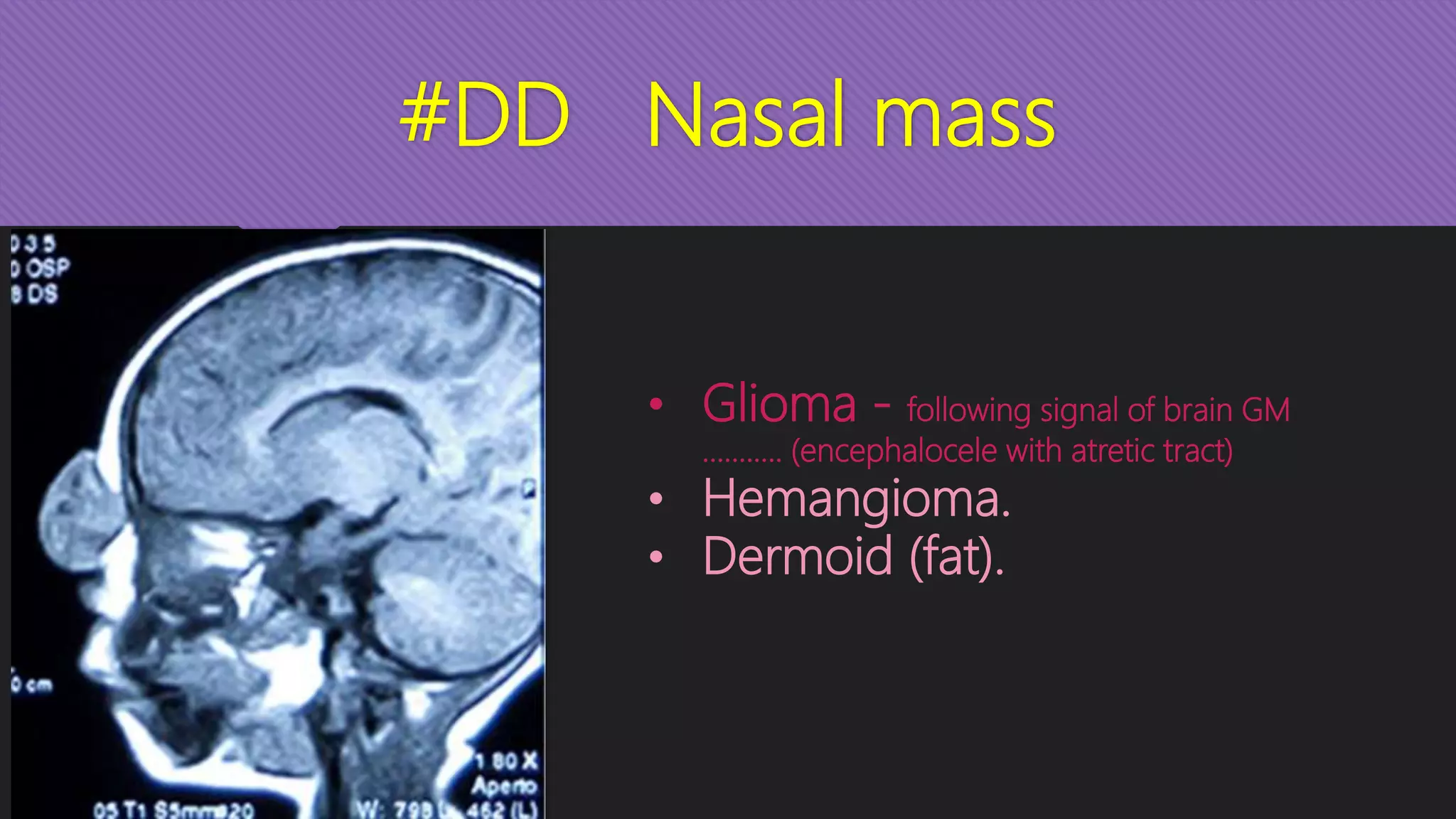 Pediatrics signs | PPTX