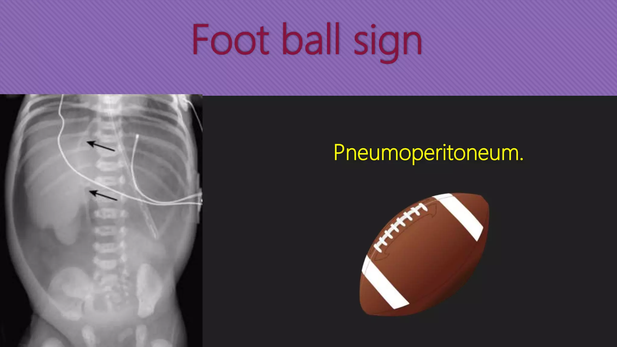 Pediatrics signs | PPTX