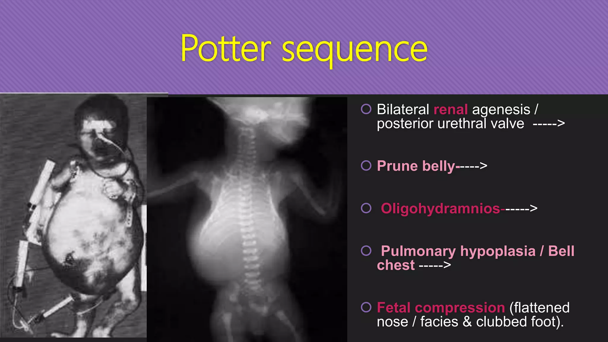 Pediatrics signs | PPTX