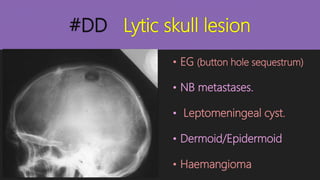 Pediatrics signs | PPT