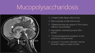 Pediatrics signs | PPT