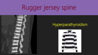 Pediatrics signs | PPT