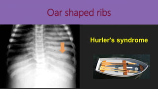 Pediatrics signs | PPT