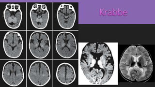 Pediatrics signs | PPT