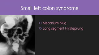 Pediatrics signs | PPT