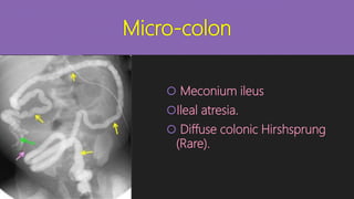 Pediatrics signs | PPT