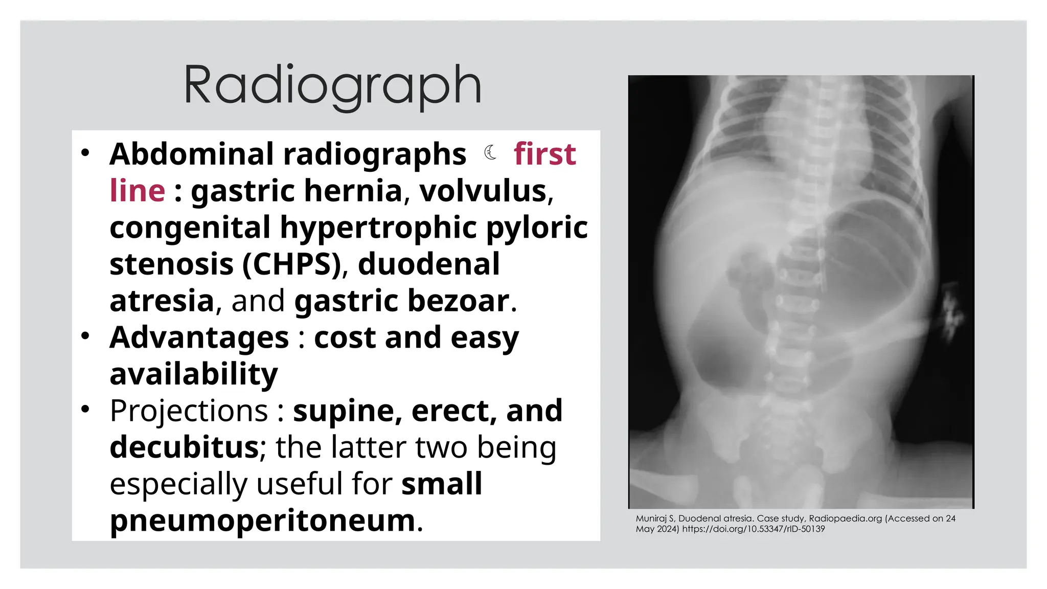 Pediatric Stomach and Duodenal Imaging copy.pptx