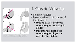 Pediatric Stomach and Duodenal Imaging copy.pptx