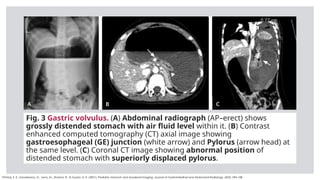 Pediatric Stomach and Duodenal Imaging copy.pptx
