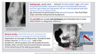 Pediatric Stomach and Duodenal Imaging copy.pptx