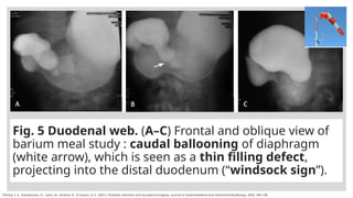 Pediatric Stomach and Duodenal Imaging copy.pptx