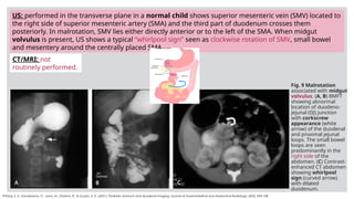 Pediatric Stomach and Duodenal Imaging copy.pptx