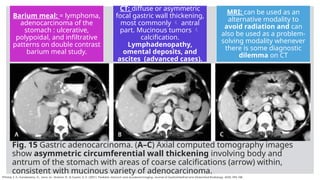 Pediatric Stomach and Duodenal Imaging copy.pptx