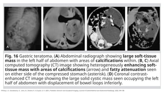Pediatric Stomach and Duodenal Imaging copy.pptx
