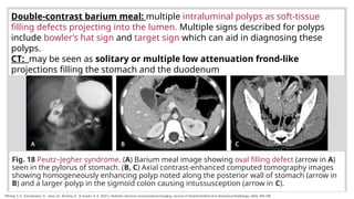 Pediatric Stomach and Duodenal Imaging copy.pptx