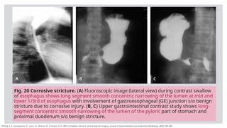 Pediatric Stomach and Duodenal Imaging copy.pptx