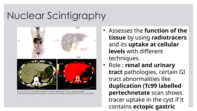 Pediatric Stomach and Duodenal Imaging copy.pptx
