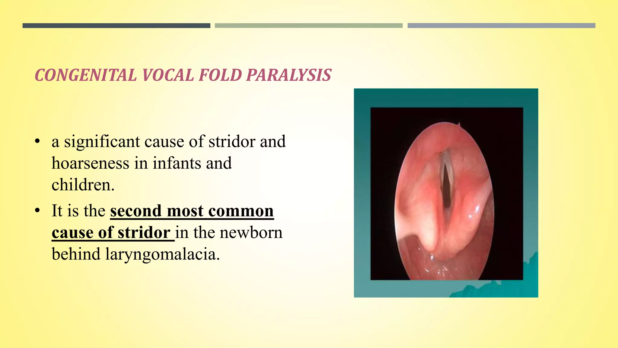 Pediatric stridor | PPTX
