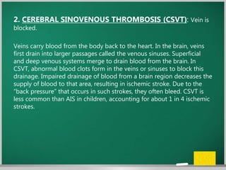 Pediatric Stroke | PPTX