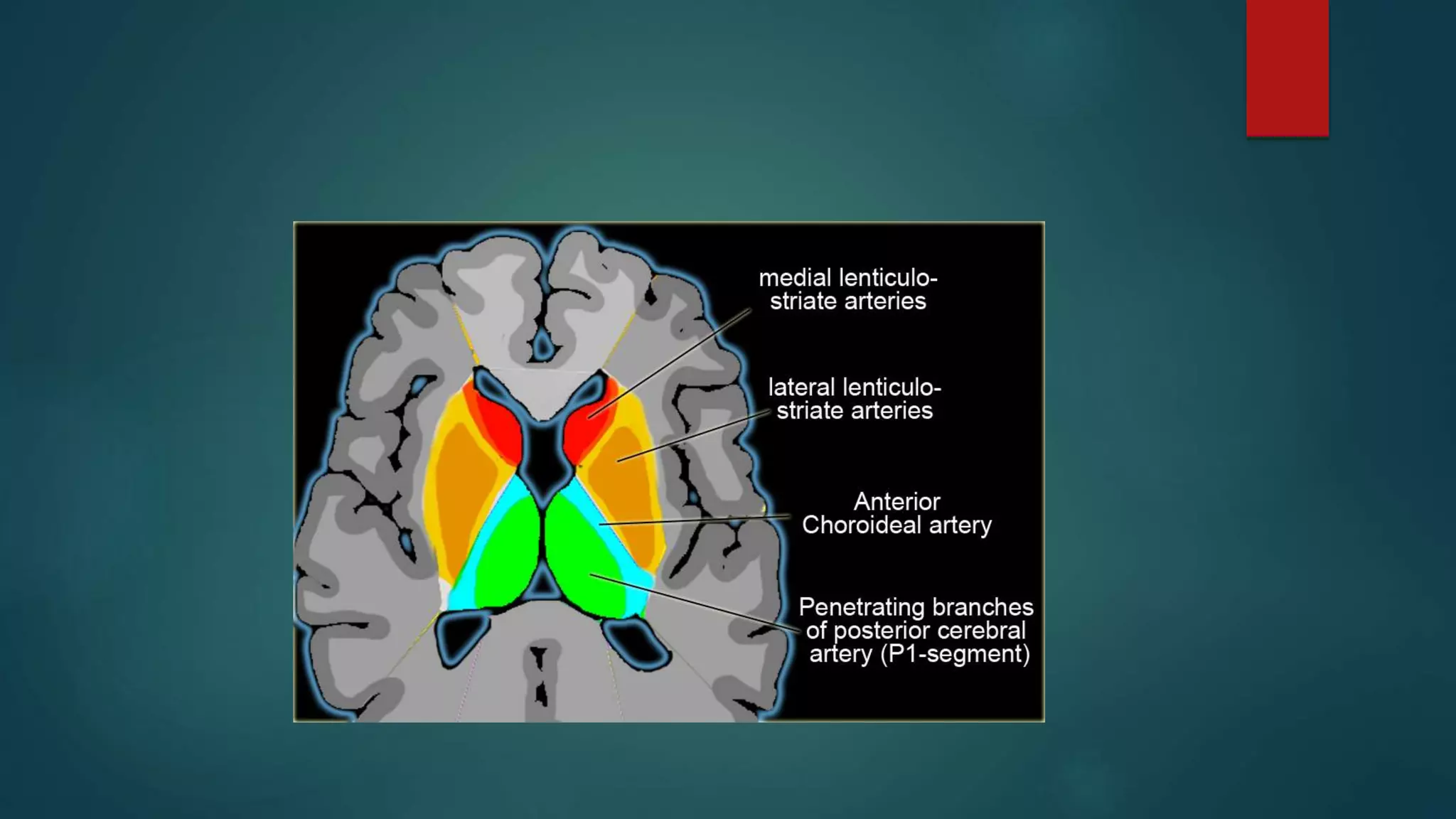 Pediatric stroke syndromes | PPTX
