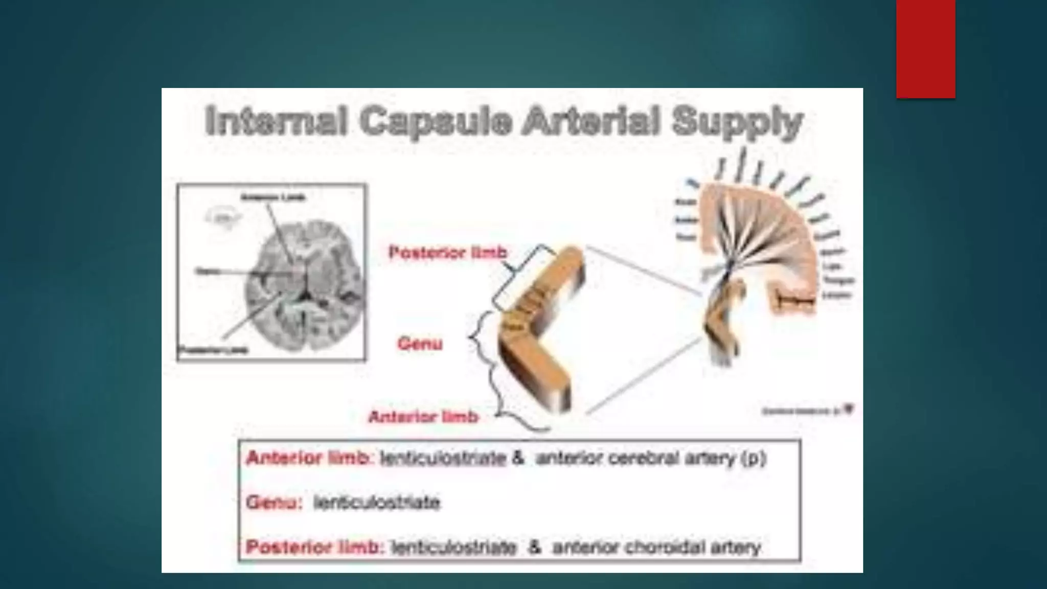 Pediatric stroke syndromes | PPTX