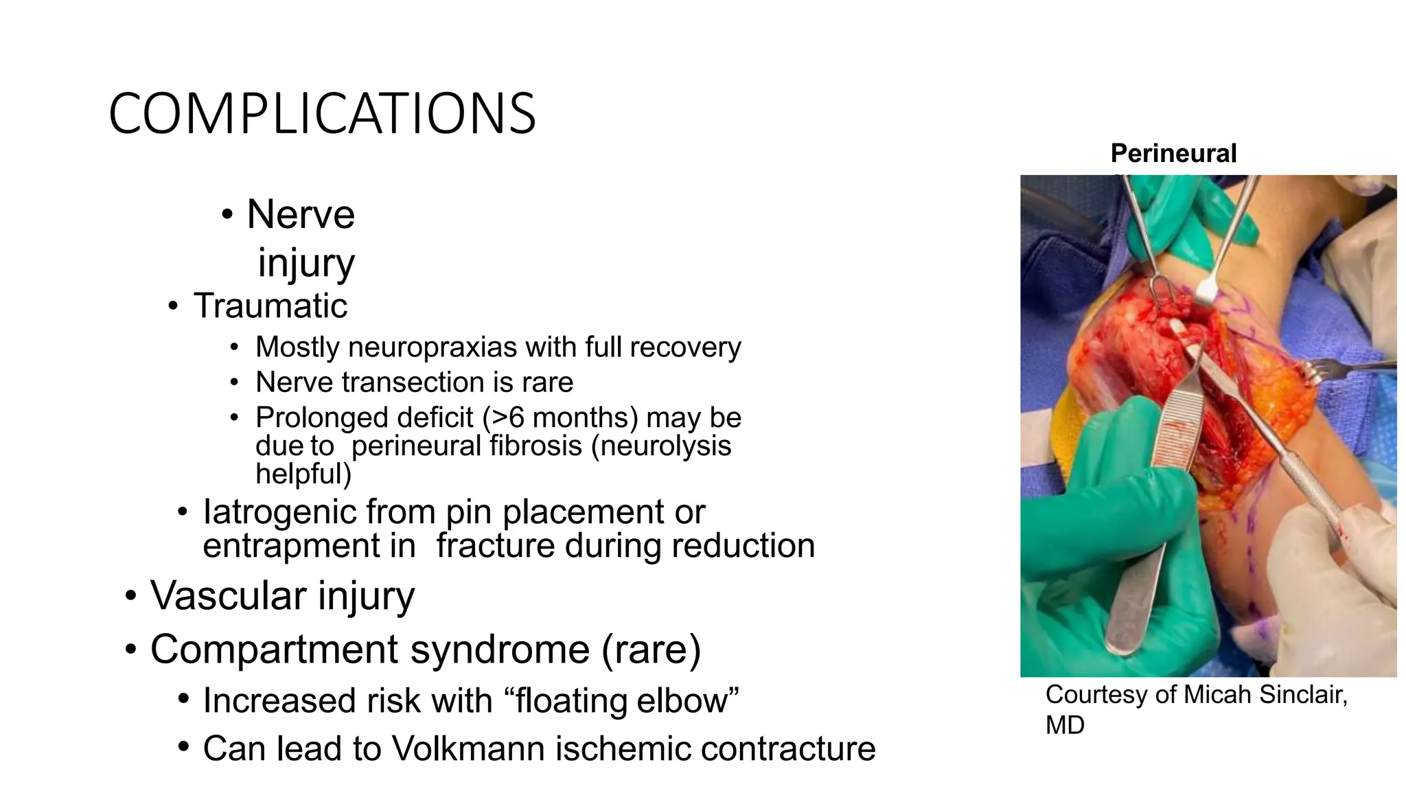 Pediatric supracondylar fjjractures.pptx