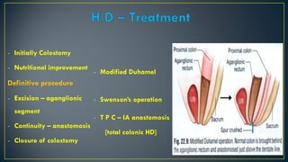 Pediatric Surgery - IHPS / ISS / Hirschsprung's Disease & ARM | PDF