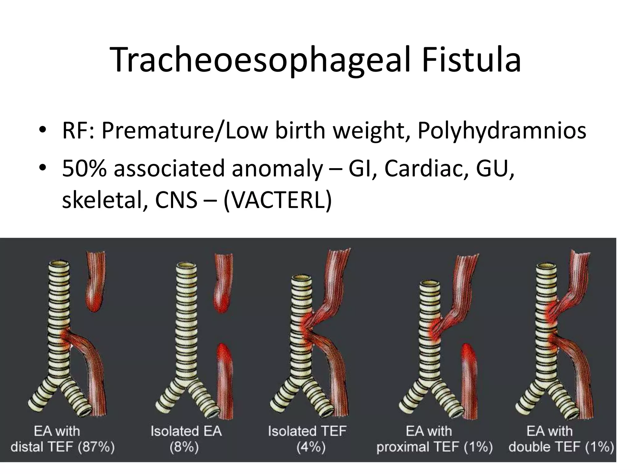 Pediatric surgery ABSITE | PPTX