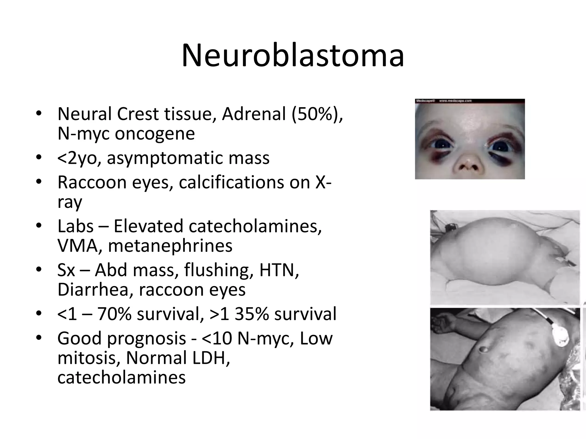 Pediatric surgery ABSITE | PPTX