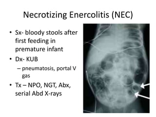 Pediatric surgery ABSITE | PPTX