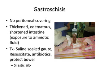 Pediatric surgery ABSITE | PPTX