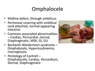 Pediatric surgery ABSITE | PPTX